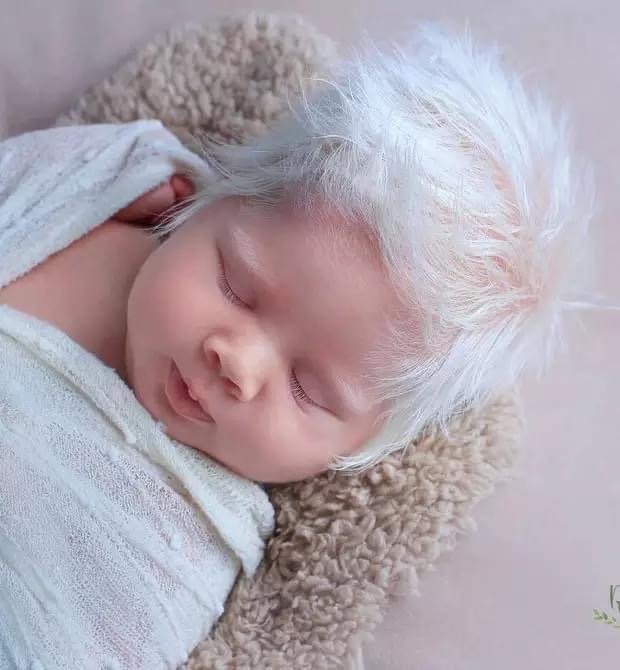 Bebê nasce com cabelos totalmente brancos e faz sucesso no interior ...